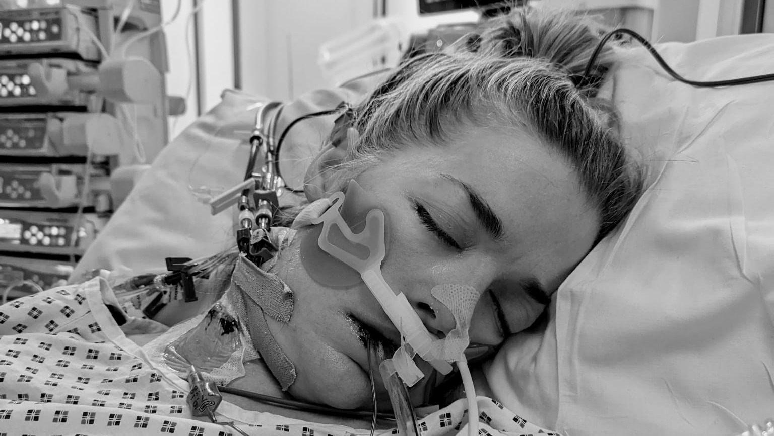 Pembrokeshire schoolteacher suffers multiple limb amputation following ...