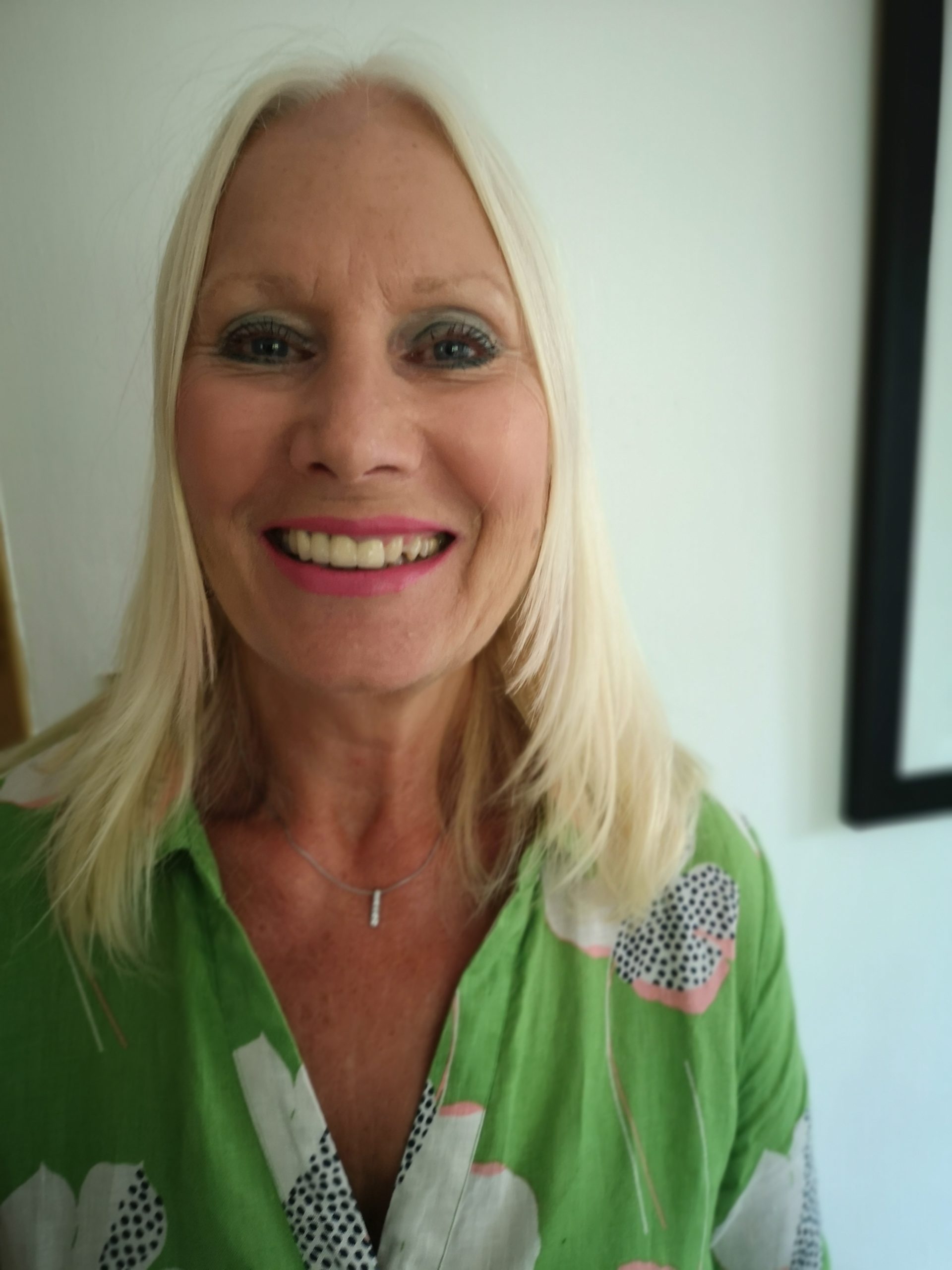 Personal trainer awarded thousands after dental bridge errors - Herald ...