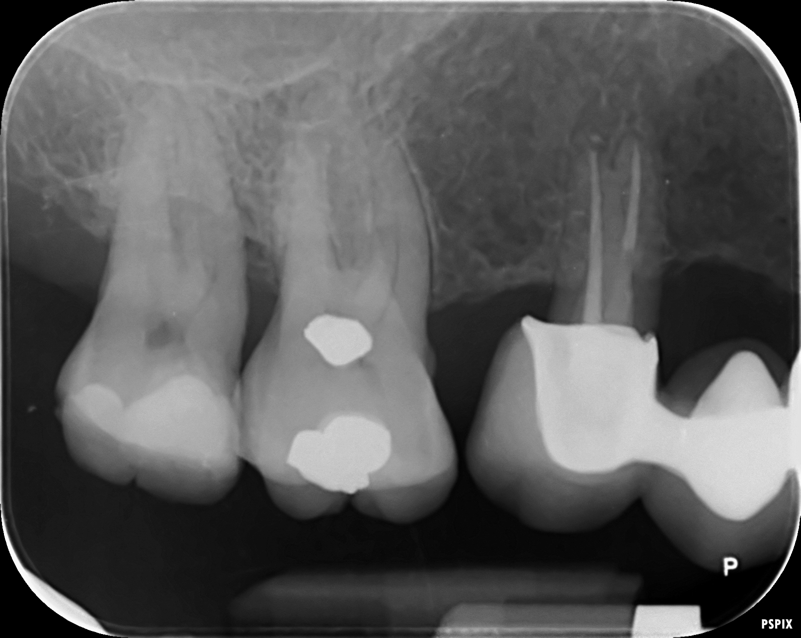 Personal trainer awarded thousands after dental bridge errors - Herald ...